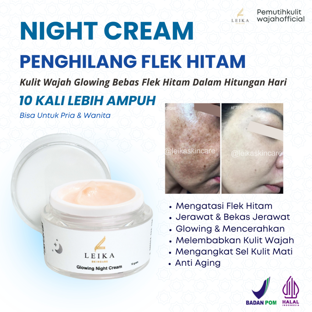 Jual Krim flek hitam membandel bpom ori cream flek hitam membandel ...