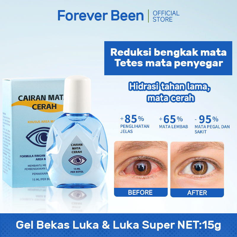 Jual Obat Tetes Mata - Menangani Katarak Mata Kering Mata Merah ...