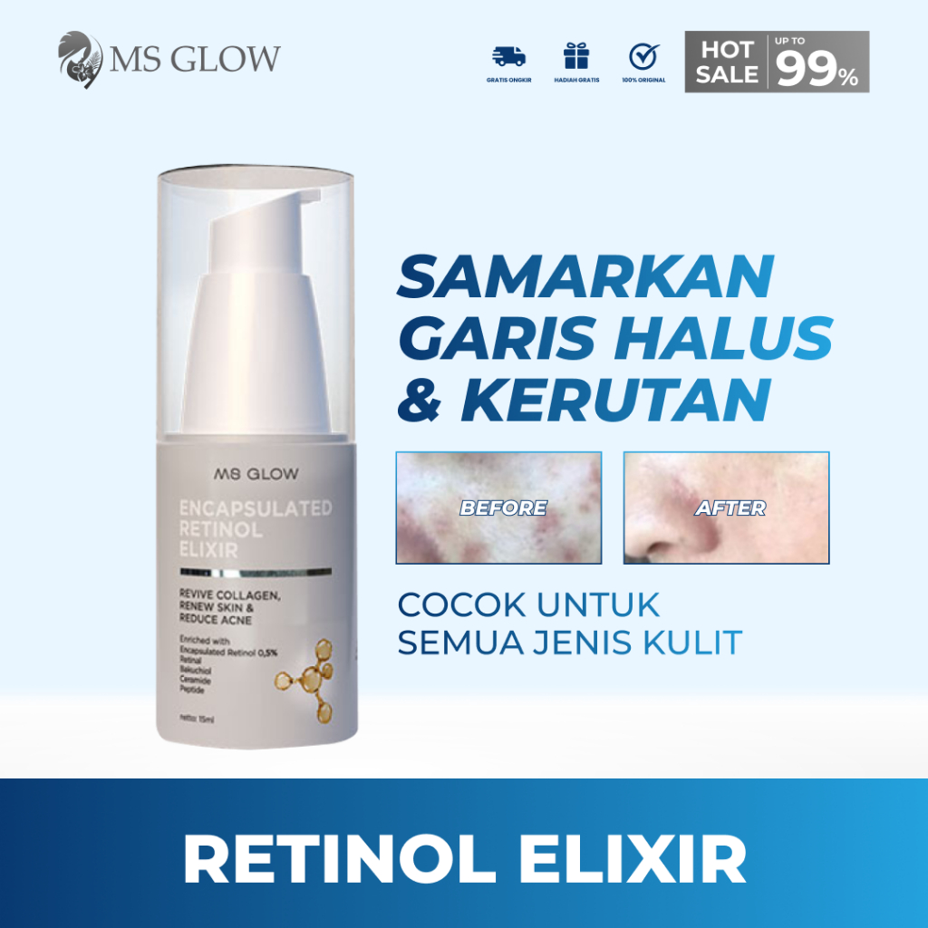 Jual MS GLOW ELIXIR RETINOL – PROMO SPESIAL SERUM ANTI AGING, PERBAIKI SKIN BARRIER & CERAHKAN ...