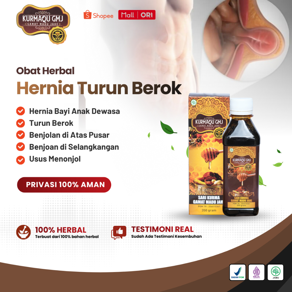Jual Kurmaqu GMJ - Obat Hernia Turun Berok Usus Turun Hernia Inguinalis ...