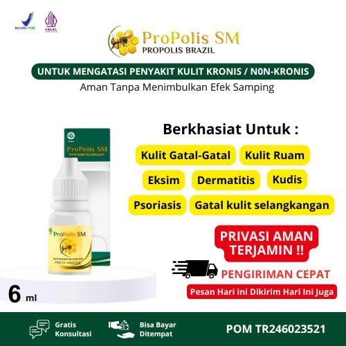 Jual Obat Ringworm, Penghilang kurap membandel alami, ruam merah pada ...