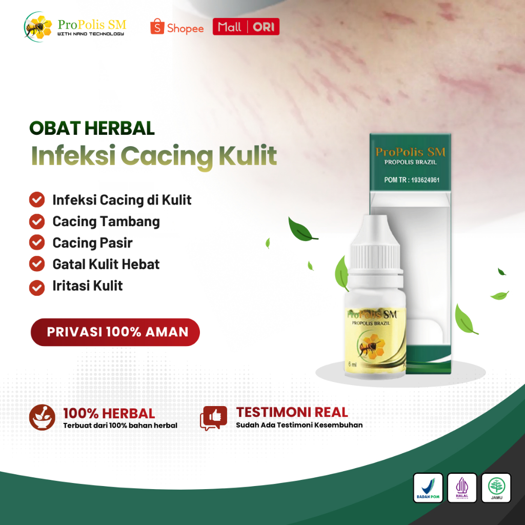 Jual Obat Infeksi Cacing Kulit Pembasmi Larva Cacing Tambang Cacing ...