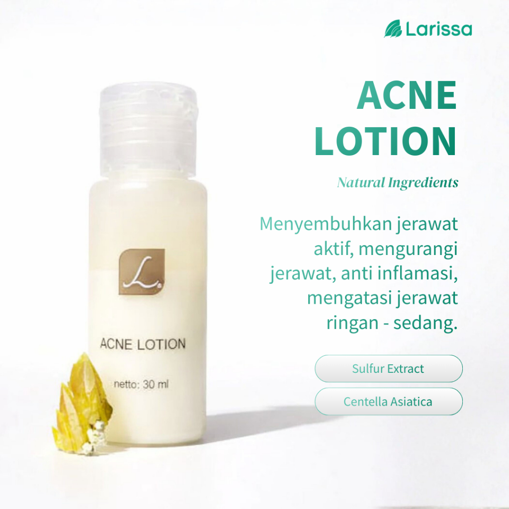 Jual Larissa Acne Lotion - Obat Jerawat Ampuh JERAWAT / JERAWAT AKTIF ...