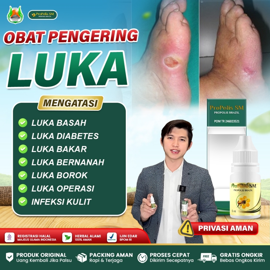 Jual Obat Luka Luar Cepat Kering, Luka Diabetes, Luka Basah, Luka Bakar ...