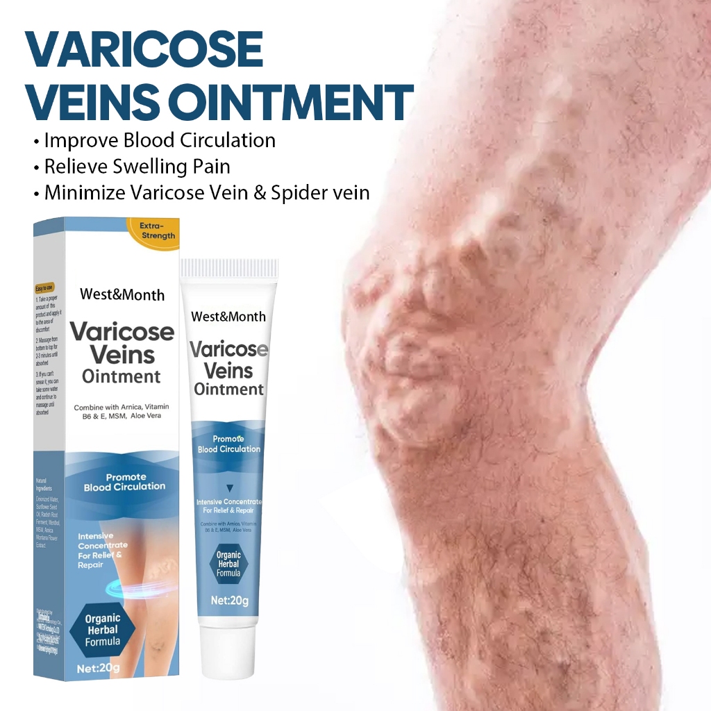 Jual West&Month Varicose Veins Cream 20g Benjolan Vena Varises ...