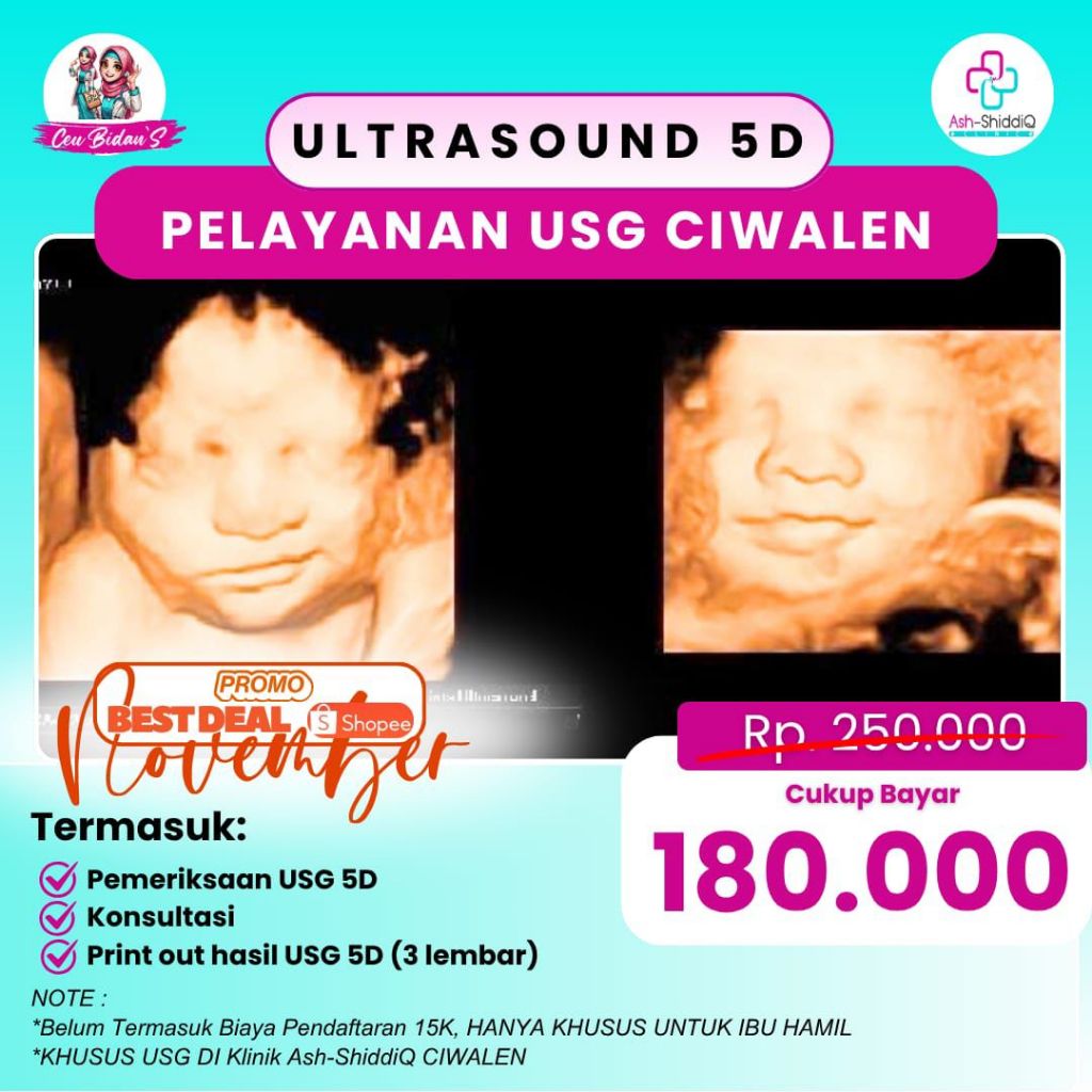 Jual USG 5D PROMO HEBOH NOVEMBER - Print Out hasil USG 5D (1 Lembar ...