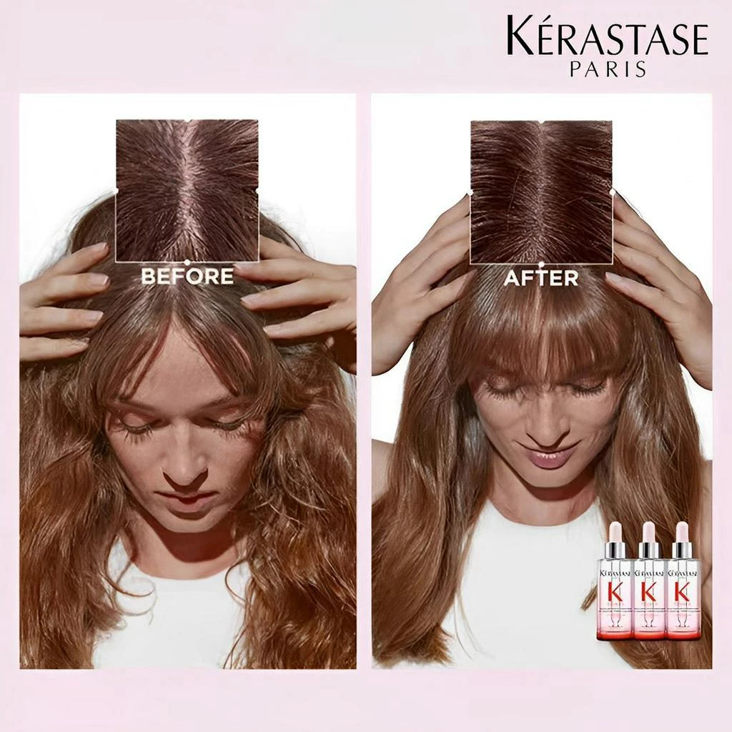 Jual Kerastase Genesis Serum 30ml Anti Hair Fall Serum/ untuk Rambut ...