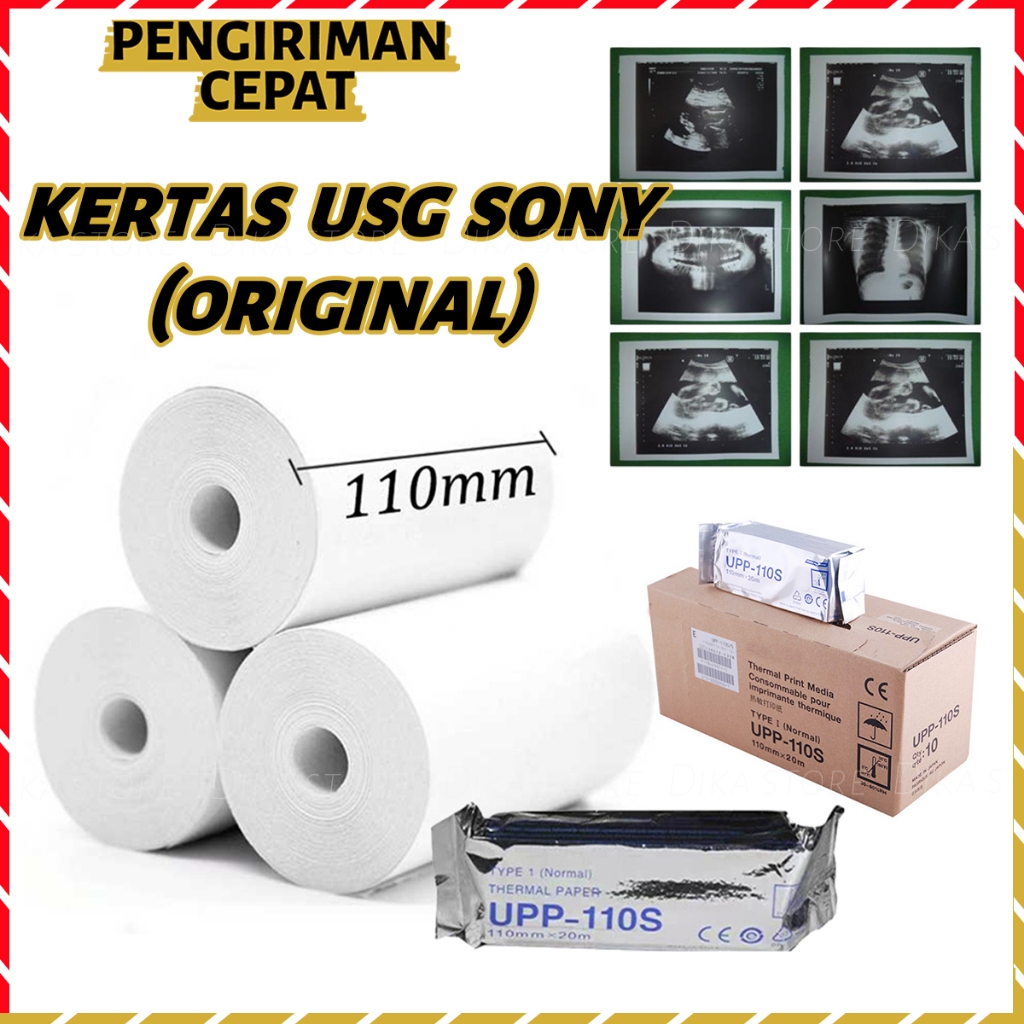 Jual 110mm x 20m Original Kertas Thermal Kertas USG Sony UPP110S ...