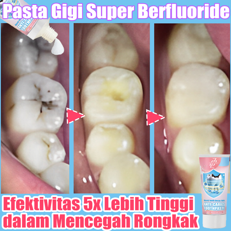 Jual Pasta Gigi Herbal Alami dengan Fluoride - Anti Rongkak Kuat ...