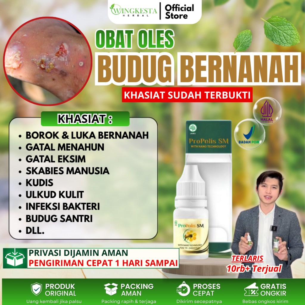 Jual Obat Oles Budug, Borok, Tetes Gatal Bernanah, Herpes, Obat Budug ...