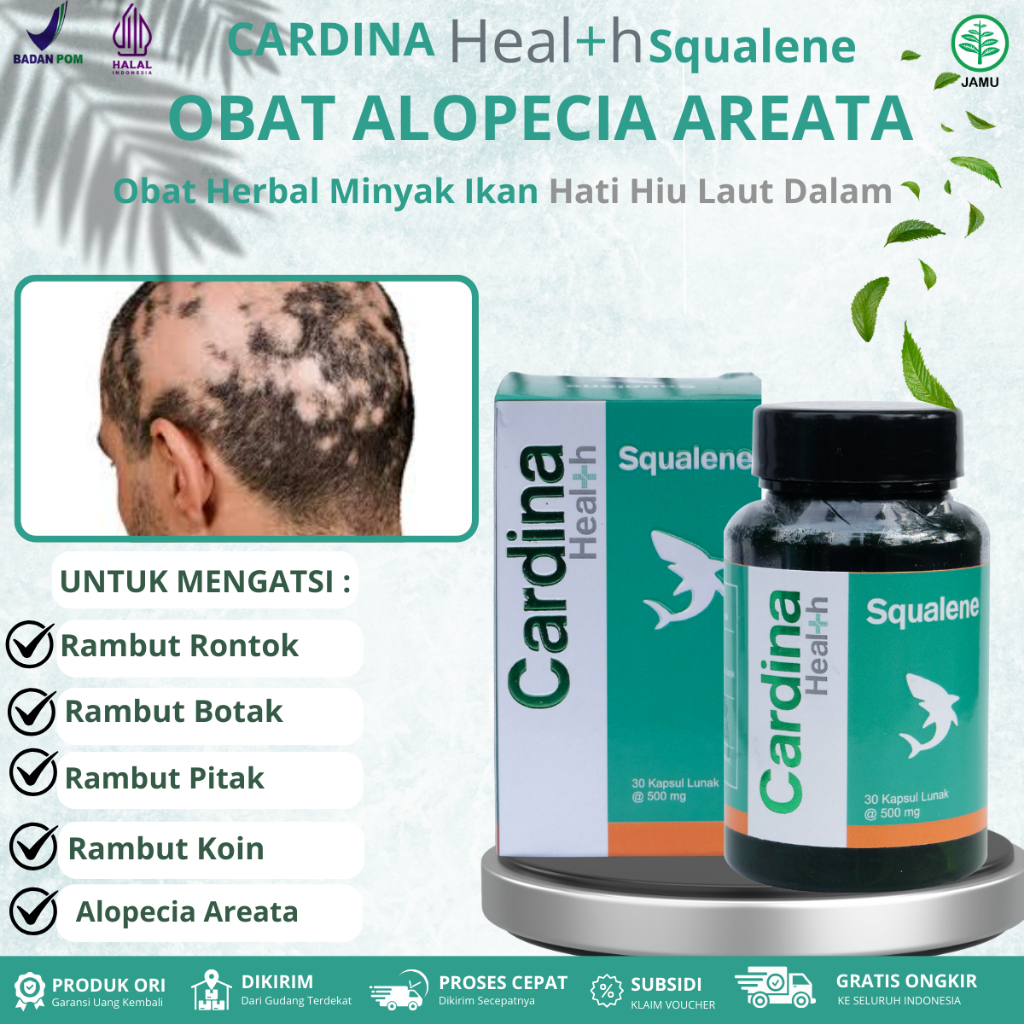 Jual Cardina Squalene Untuk Penumbuh Rambut, Alopecia Areata ...