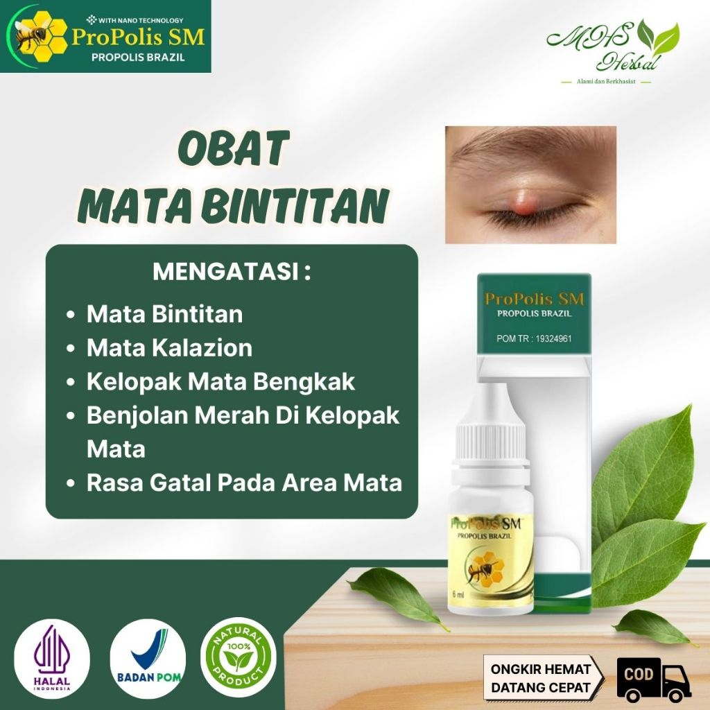 Jual Obat Mata Bintitan, Kelopak Mata Bengkak, Mata Kalazion ...