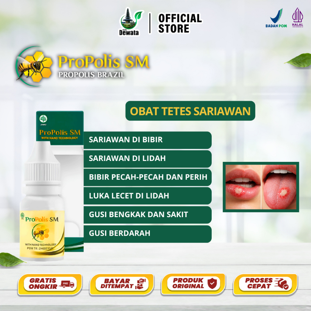 Jual Obat Sariawan Di Bibir Dan Lidah Atasi Bau Mulut Bibir Kering Dan ...