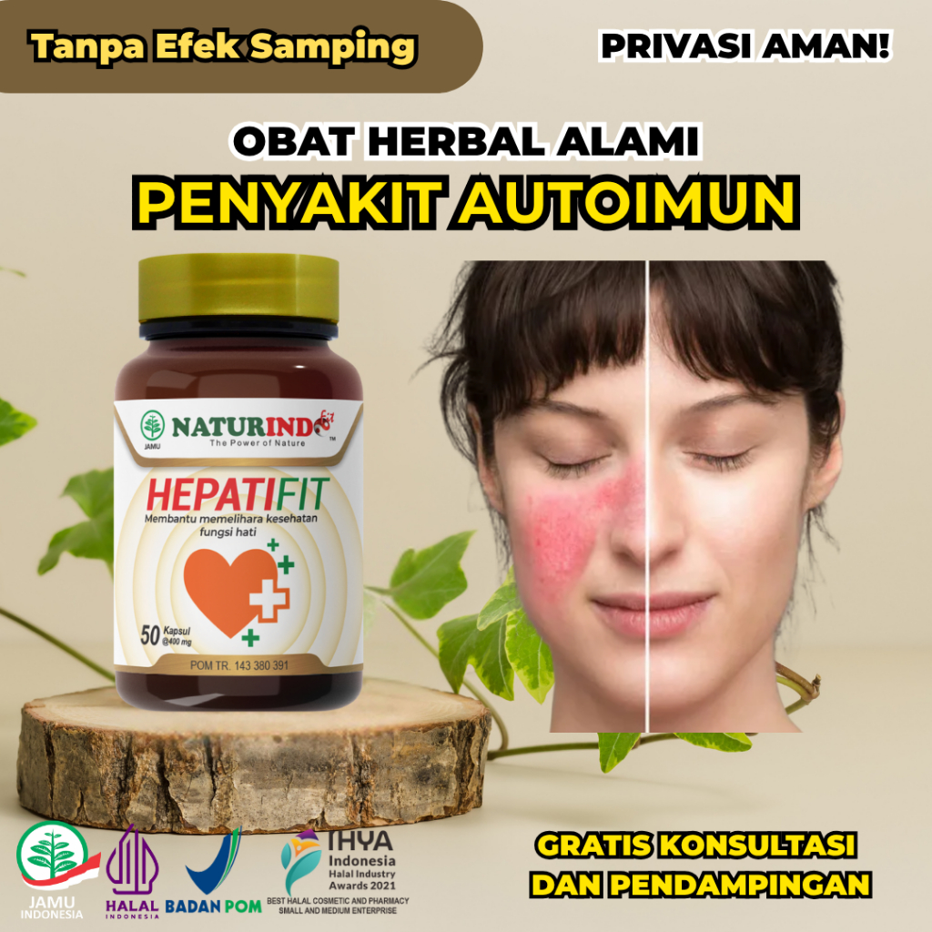 Jual Obat Autoimun Psoraris Lupus Hepatifit Naturindo Herbal Alami ...