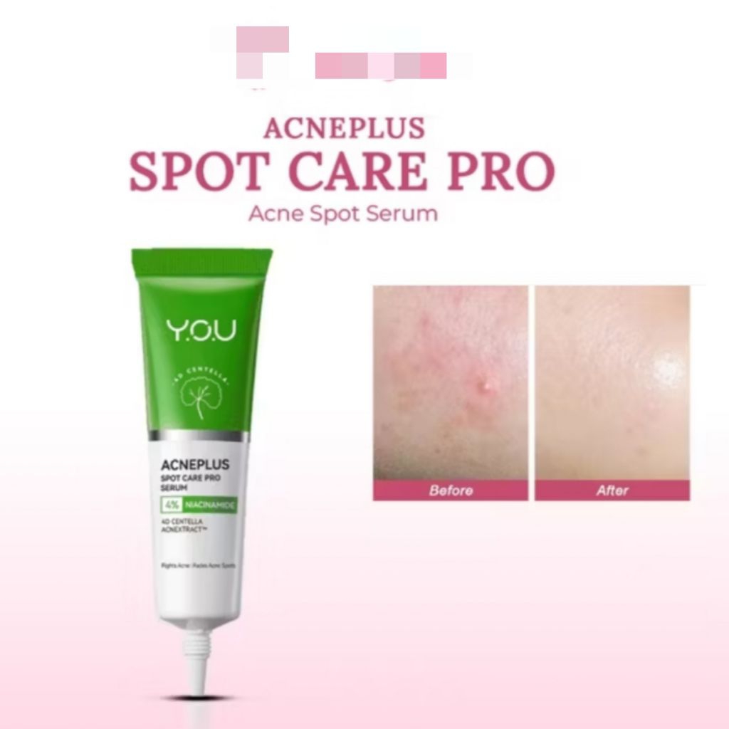 Jual YOU Acne Plus Spot Care Pro Serum | Shopee Indonesia