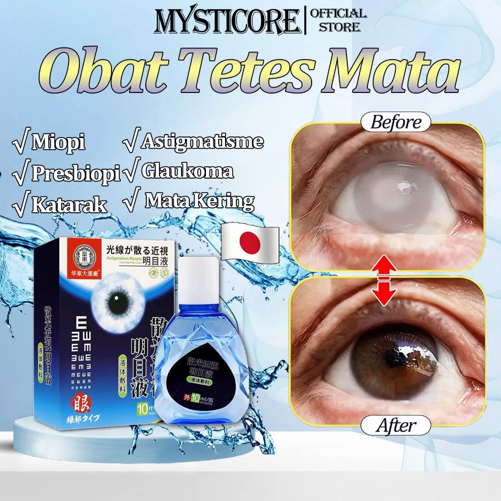 Jual MYSTICORE Obat Tetes Mata Eye Drop Obat Mata Katarak Obat Sakit ...