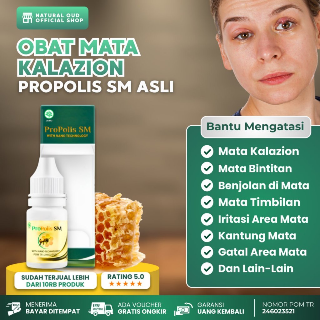 Jual Obat Mata Kalazion, Obat Mata Bintitan Pada Anak Dan Dewasa ...