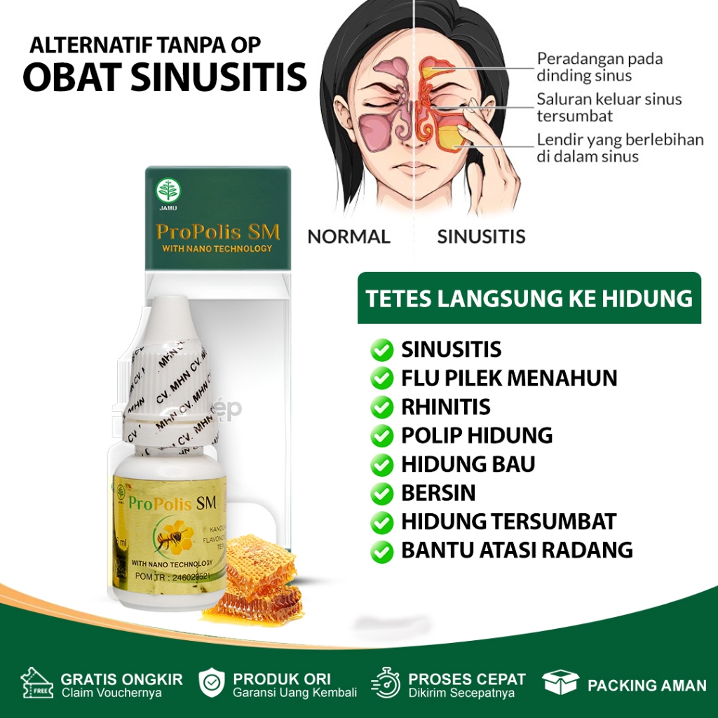 Jual Obat Sinusitis Flu Filek Menahun Hidung Tersumbat Radang Hidung ...