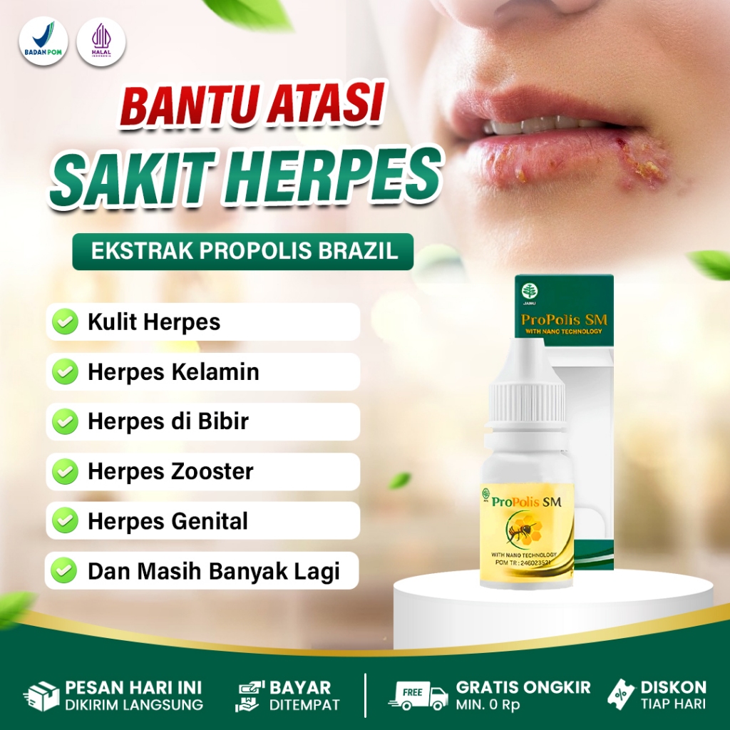 Jual Obat Herpes Kulit, Herpes Zoster, Herpes Kelamin, Herpes Bibir ...