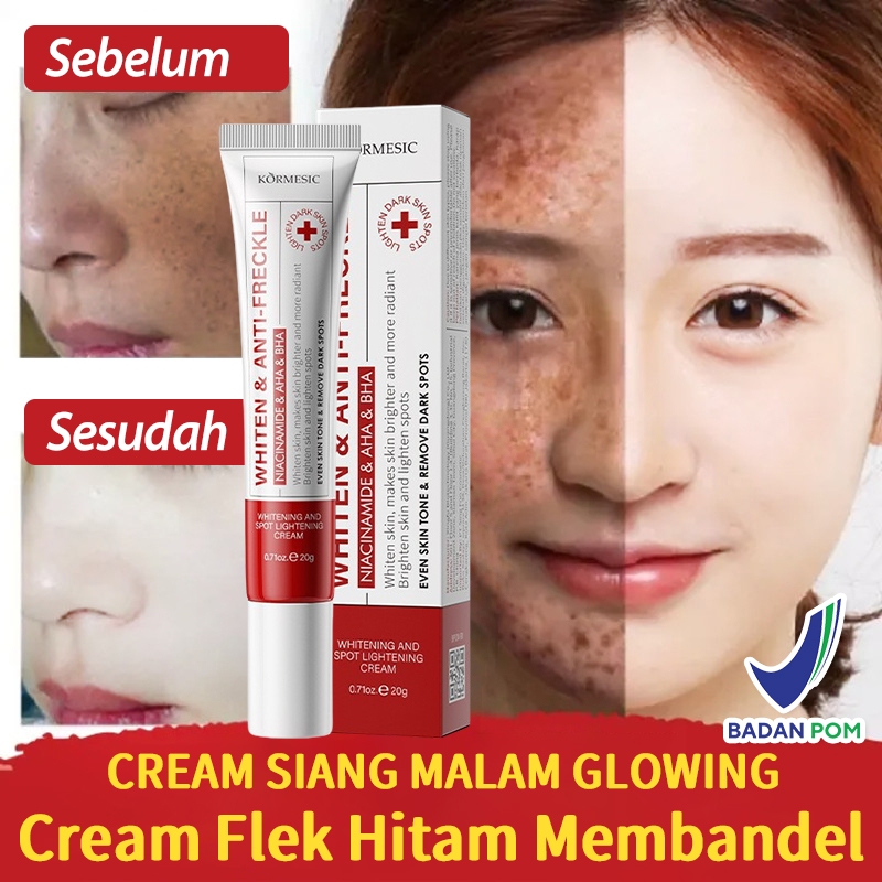Jual Krim Menghilangkan Flek Hitam Terlengkap & Harga Terbaru Juni 2026 ...