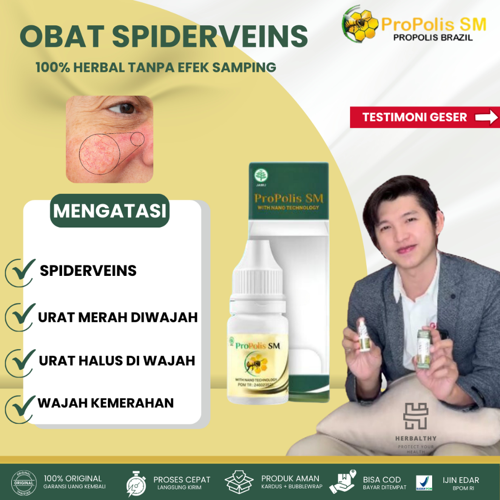 Jual Obat Herbal Anti Spider Vein, Obat Herbal Penghilang Urat Halus Di ...