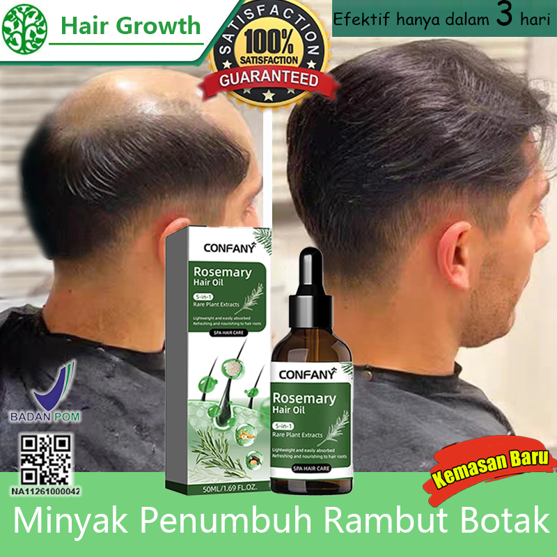 Jual Obat Penumbuh Rambut Alami Terlengkap & Harga Terbaru Juni 2026 ...
