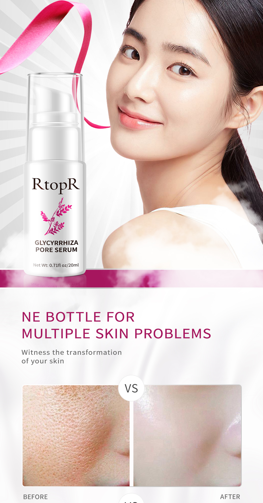 Jual [BPOM] RtopR Serum Perbaikan Pori-pori Wajah Glycyrrhiza Wajah ...