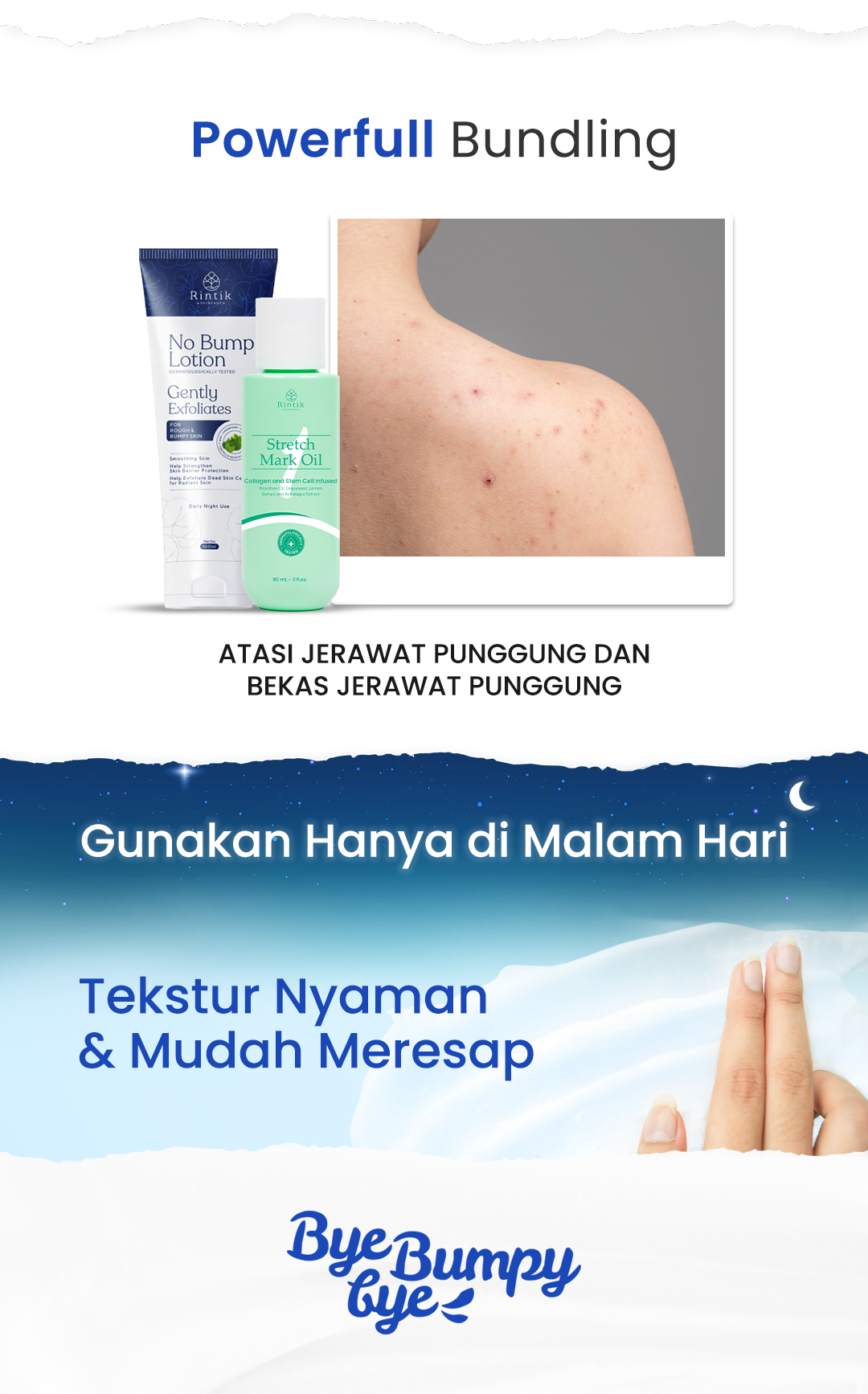 Jual Bundling Anti Stretchmark & Bruntusan Tubuh (1 pcs Stretch Mark ...