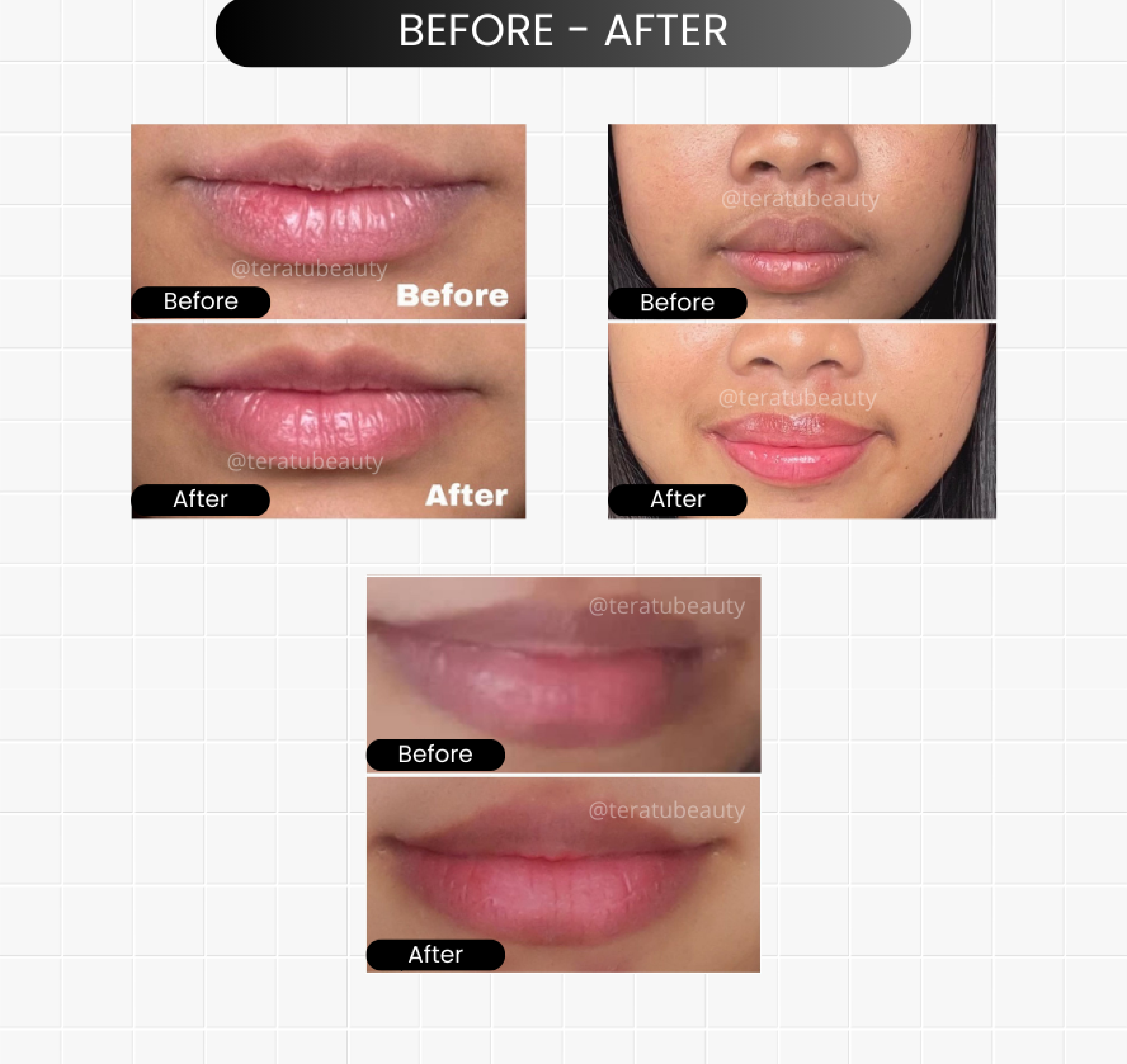 Jual TERATU BEAUTY Lip Tinted Treatment (Lip Balm Bikin Bibir ...