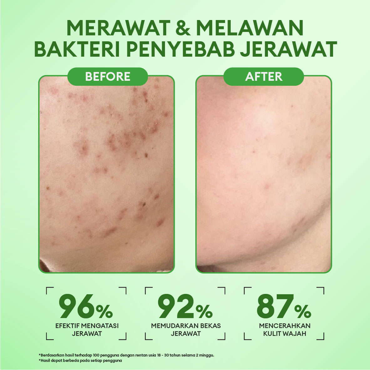 Jual Animate Intense Acne Solution Day Cream 10 gr | Shopee Indonesia