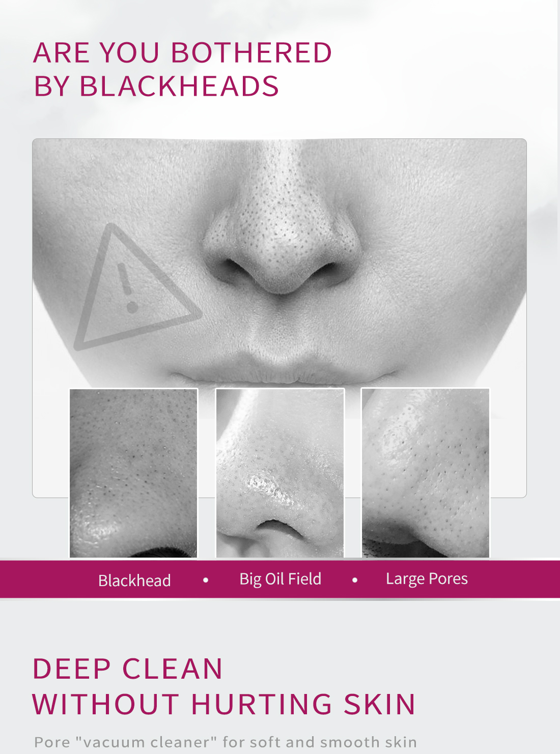 Jual RtopR Mangga Penghilang Komedo Masker Membersihkan Pori-pori ...