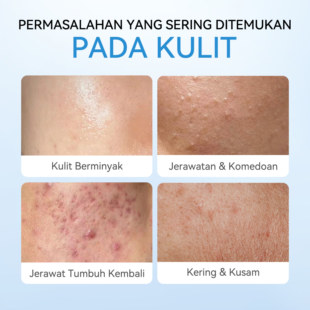 Jual [60 Pads] FOCALSKIN Acne Exfoliating Clear Pad Cica Pad / Kapas ...