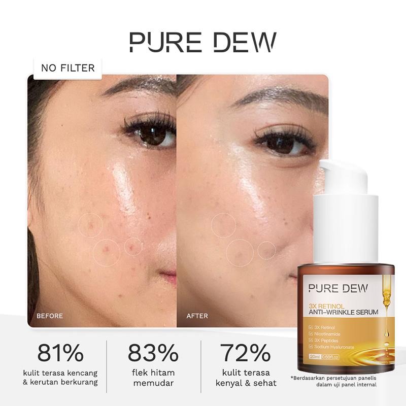 Jual PURE DEW -Essence 3x Retinol Serum Wajah Anti-age Serum 20ml With ...