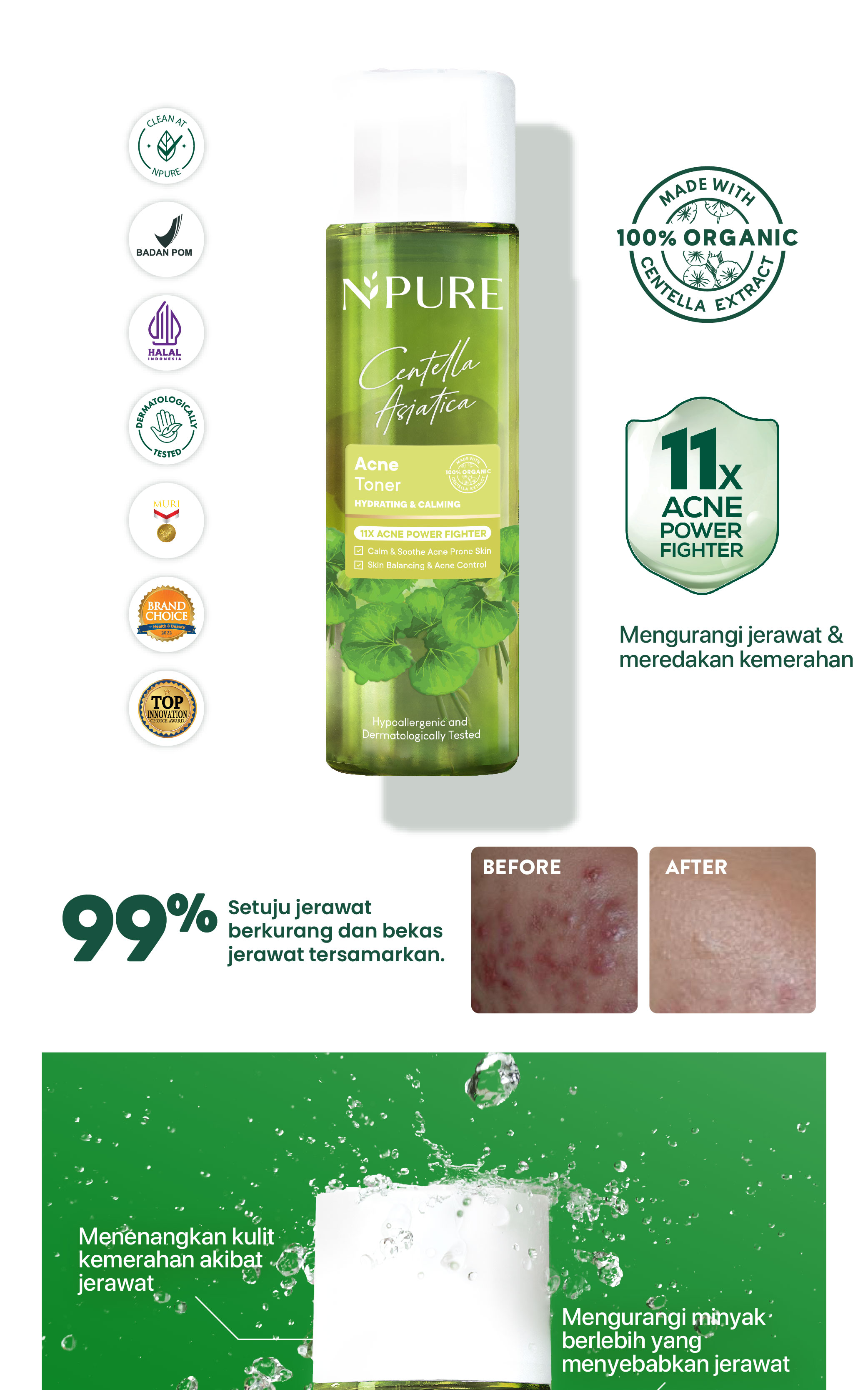 Jual EXCLUSIVE CREATOR TWINPACK TONER CICA 150ML - NPURE Acne Face ...