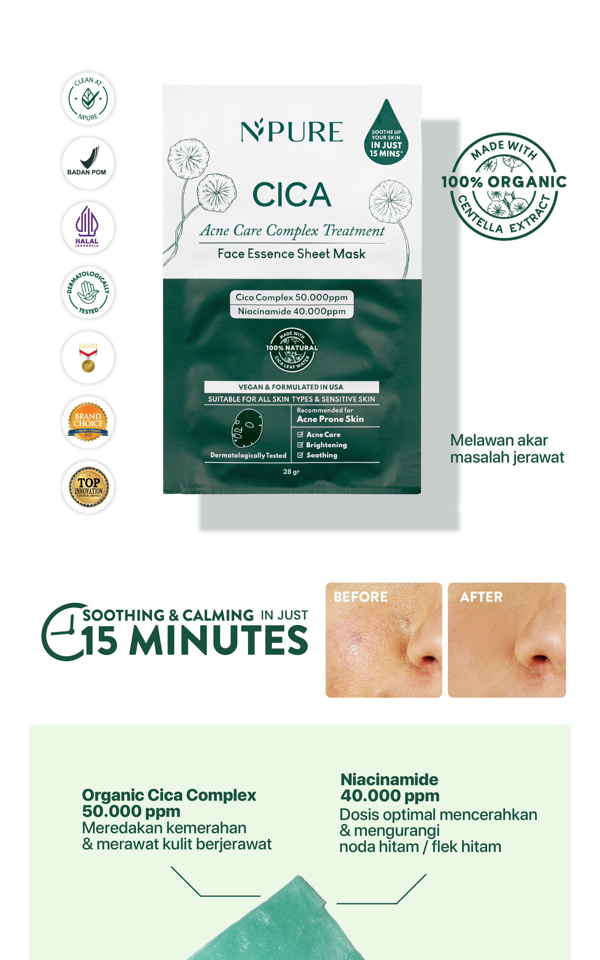 Jual NPURE Anti Acne Cica Sheet Mask / Anti Acne / Niacinamide / Masker ...