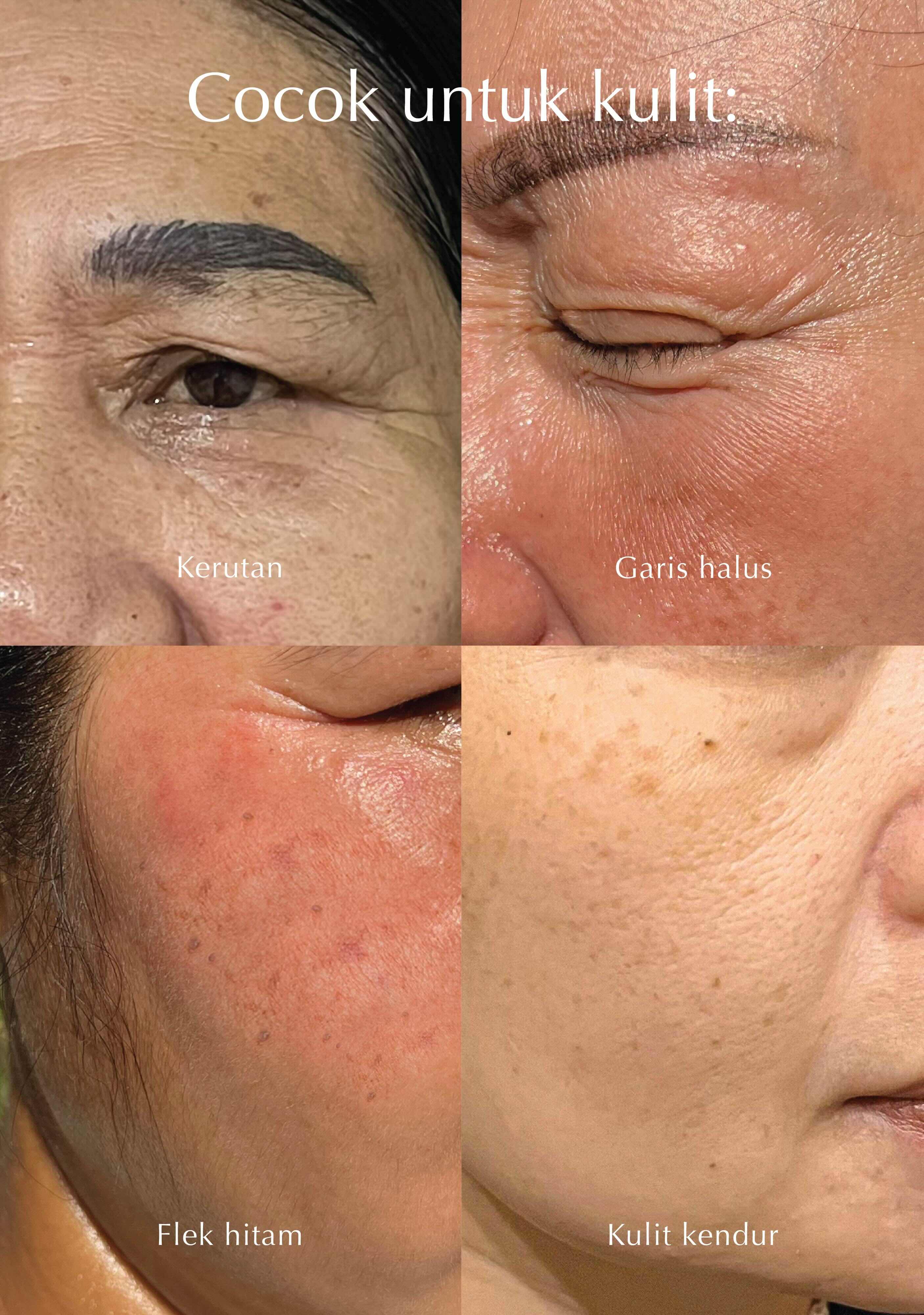 Jual [ FREE MASK ] POLYNIA | Pomegranate Revitalizing Face Mask ...