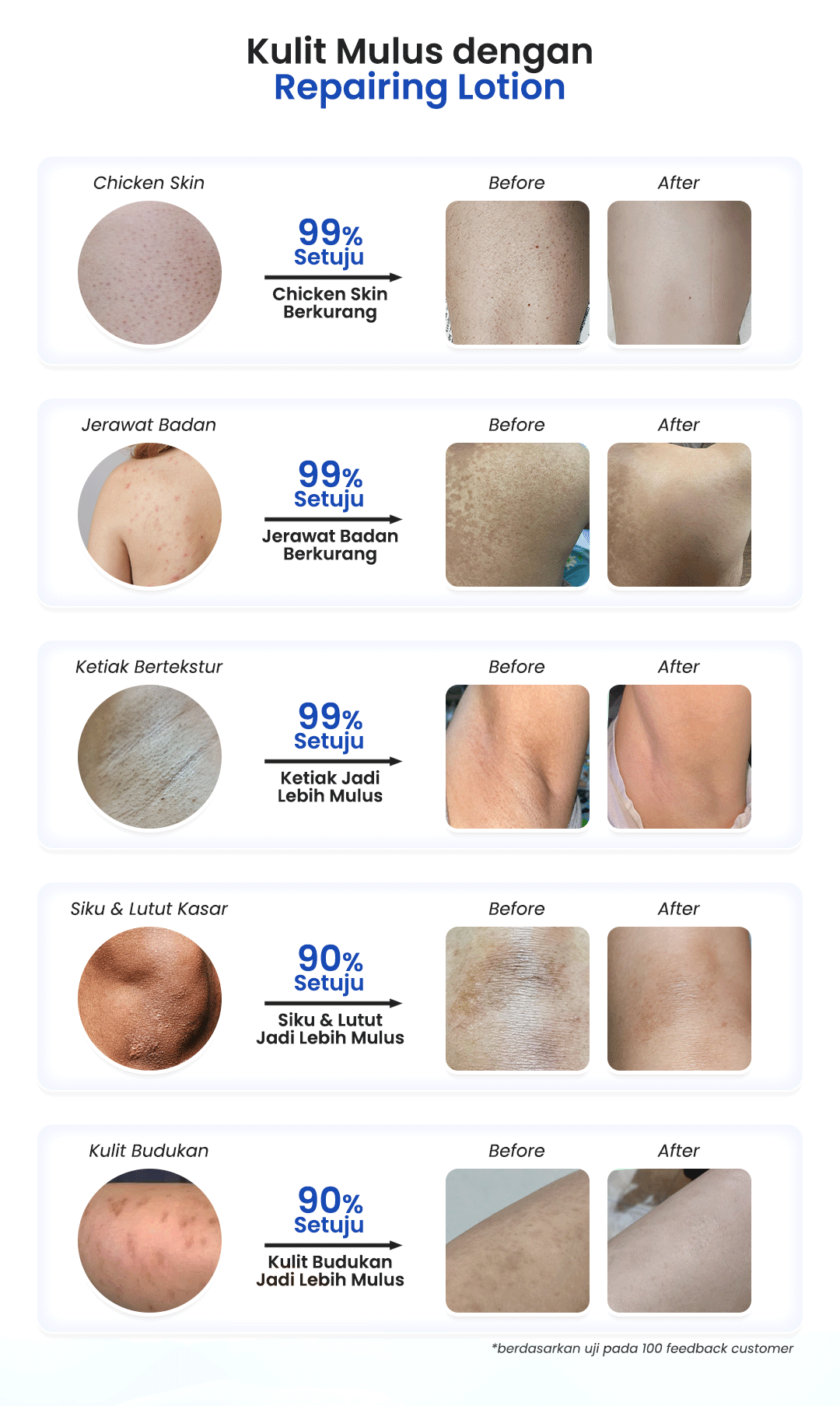 Jual Rintik Skincare - No Bump Lotion / Lotion Tubuh Kulit Bruntusan ...