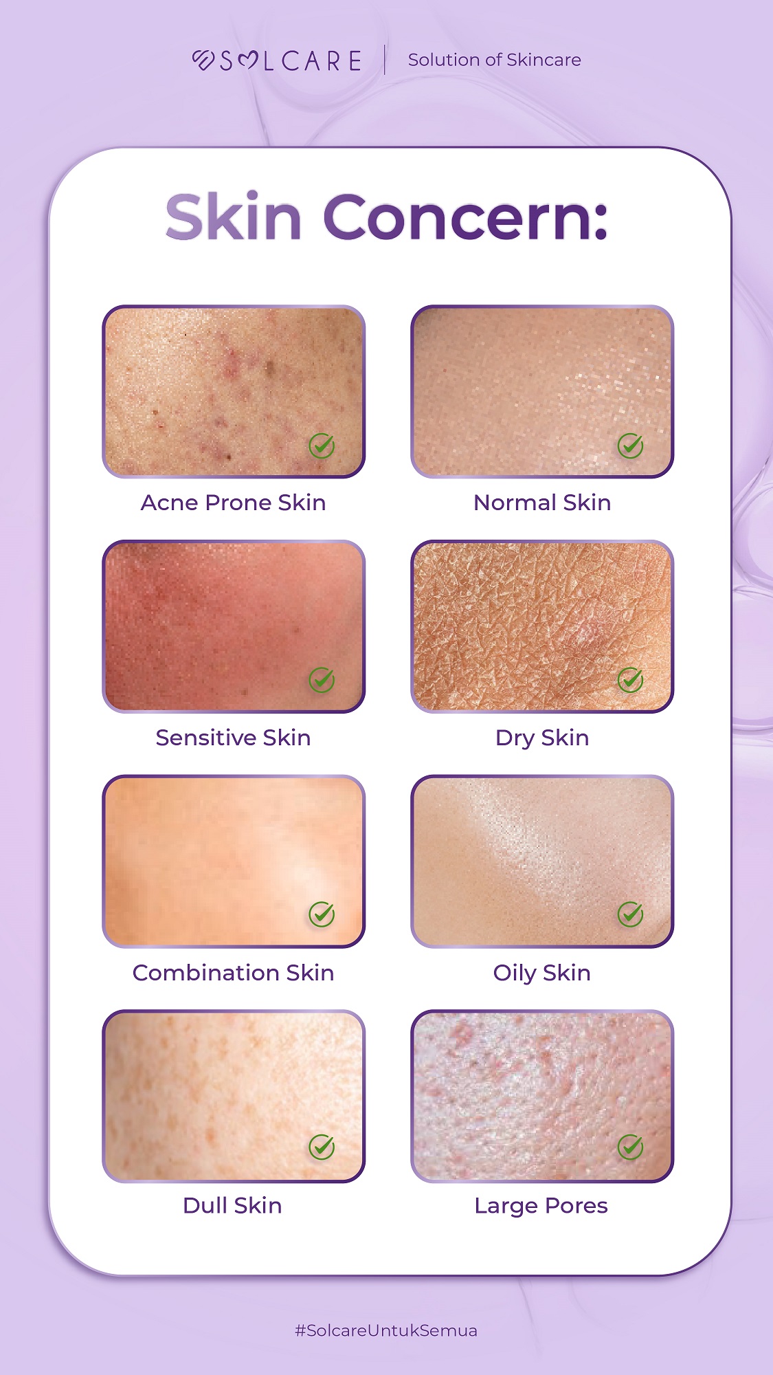 Jual BELI 1 FREE 9 Solcare Collagen Pore Minimizer Serum + DNA Salmon ...