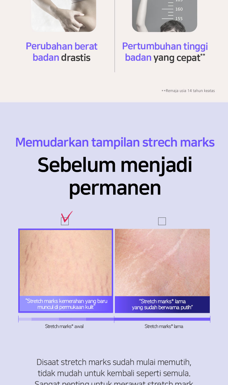 Jual ILLIYOON Stretch Mark Cream 200ml - Krim Anti Iritasi - Melindungi ...