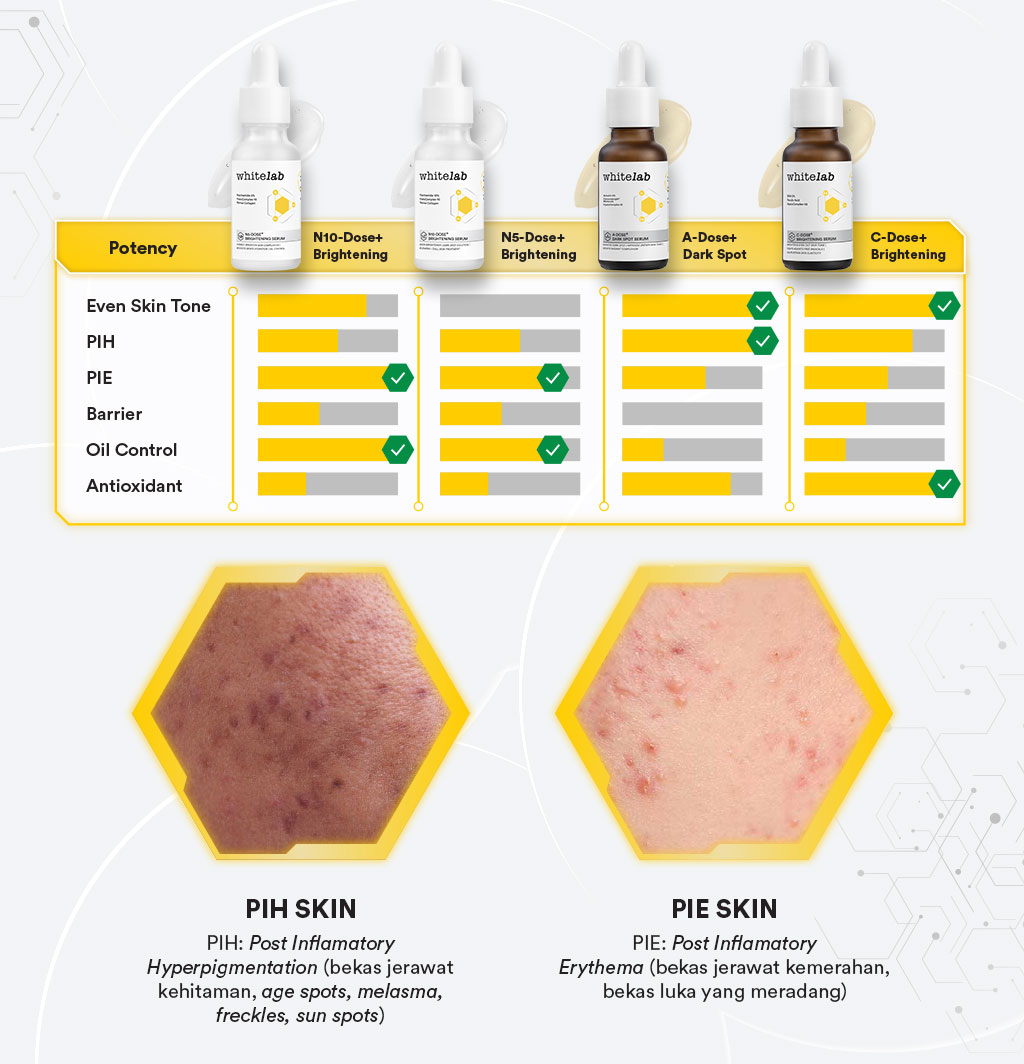 Jual Whitelab 4pcs Brightening Paket Wajah - Facial Wash, Toner, Serum ...