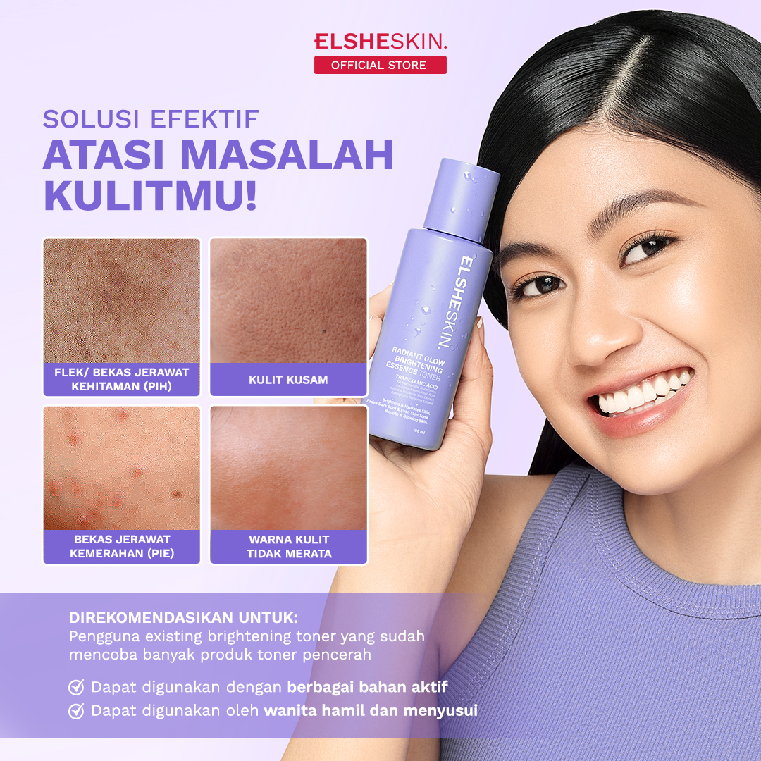 Jual Elsheskin Radiant Glow Brightening Essence Toner 100ML - Skincare ...