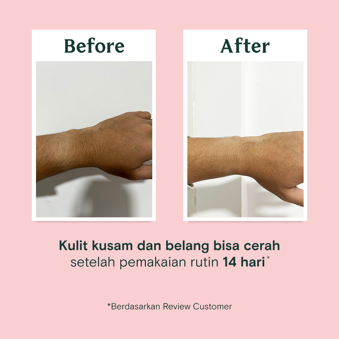 Jual Biotalk Brightening Lotion 11 Hyaluronic Acid | No Added Fragrance ...