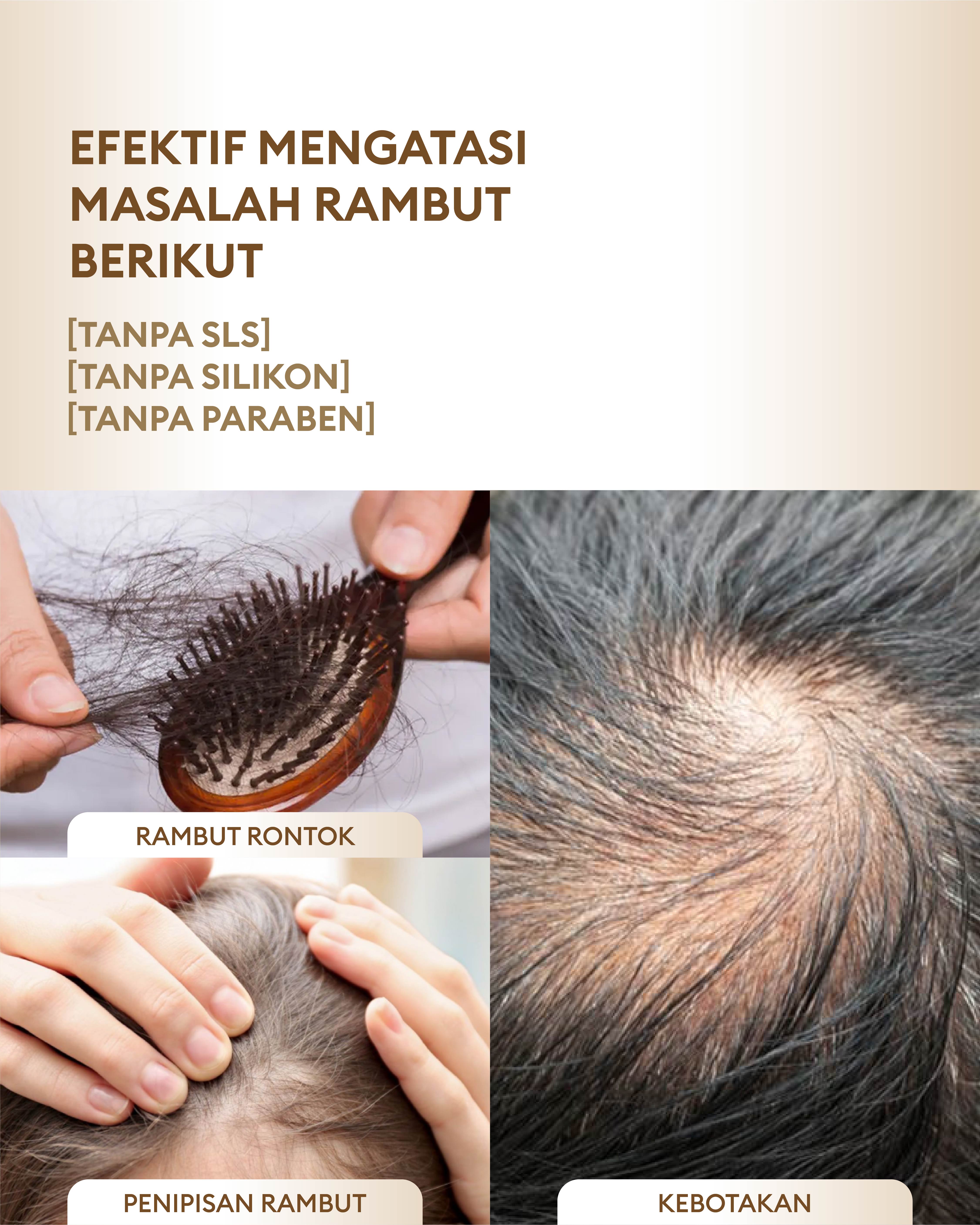 Jual THE BATH BOX - Mimosa Pro Haircare (Rambut Rontok, Menguatkan ...