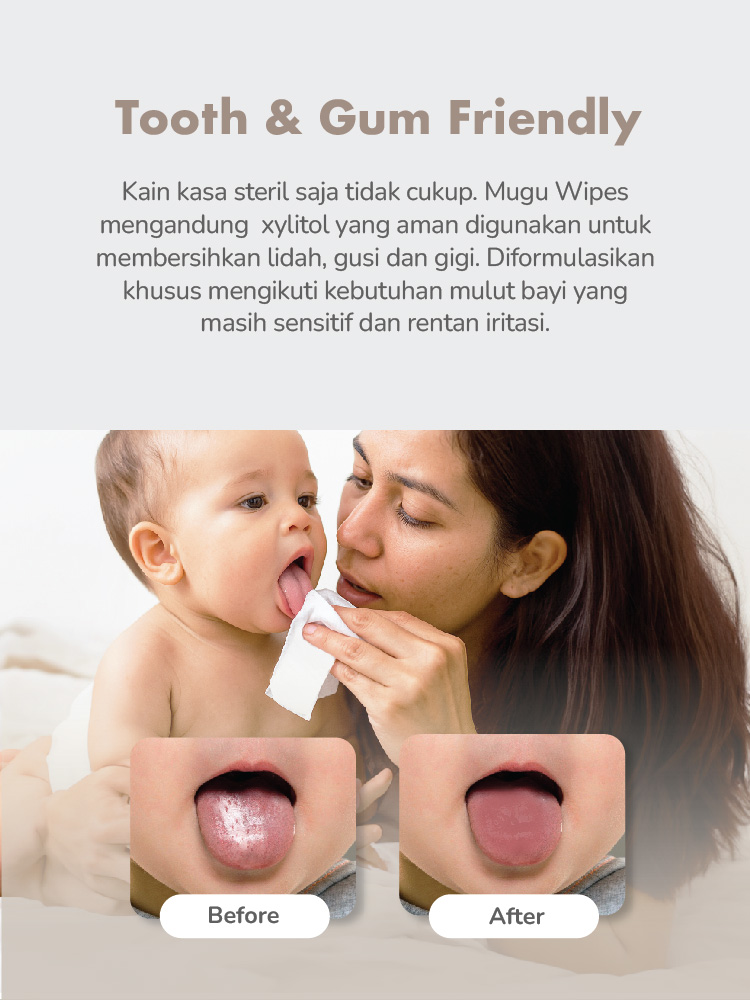 Jual [NEW] mugu Tisu Basah Pembersih Lidah dan Gigi Bayi Tooth & Gum ...