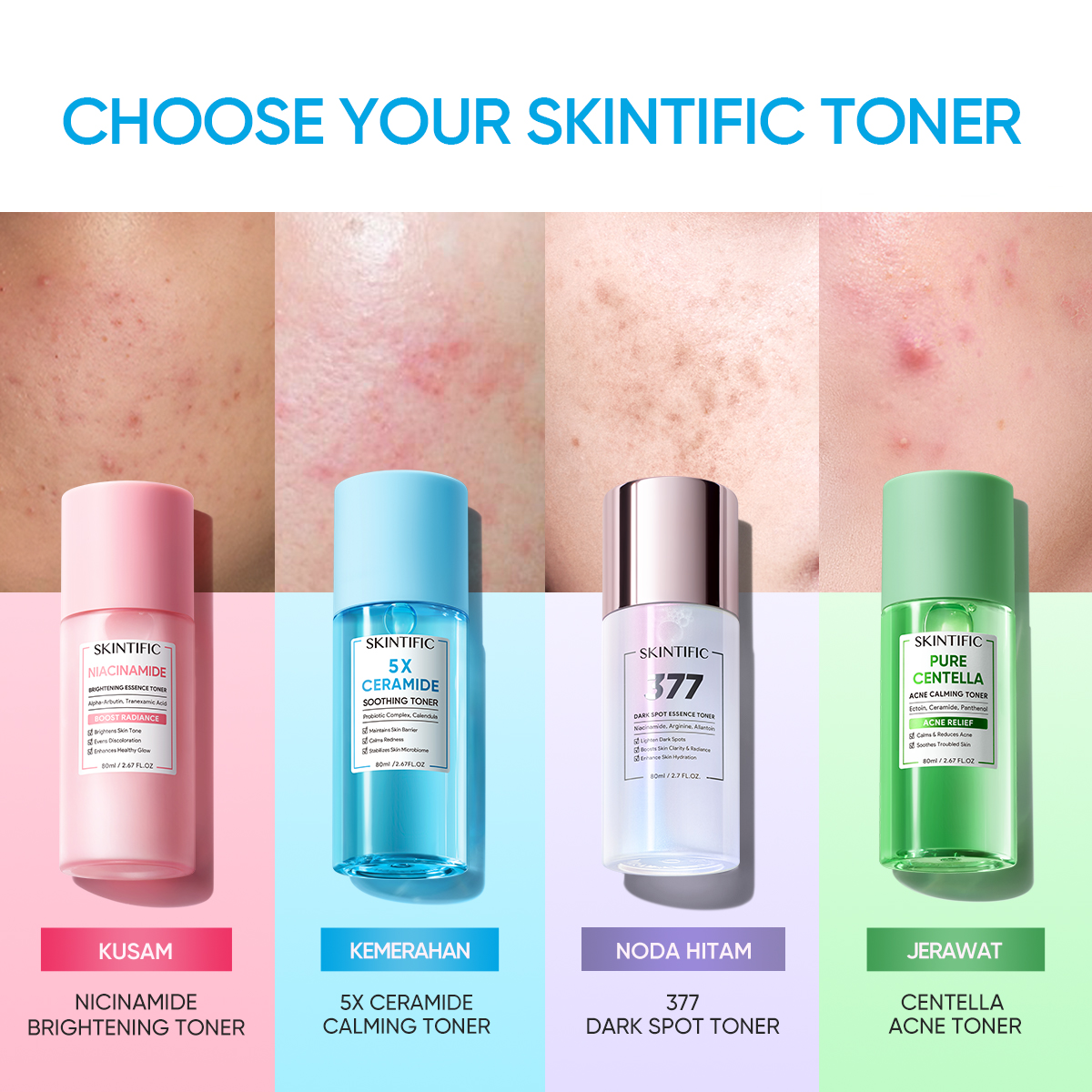 Jual SKINTIFIC - 2PCS Toner+Moisturizer Set | 377 Dark Spot Niacinamide ...
