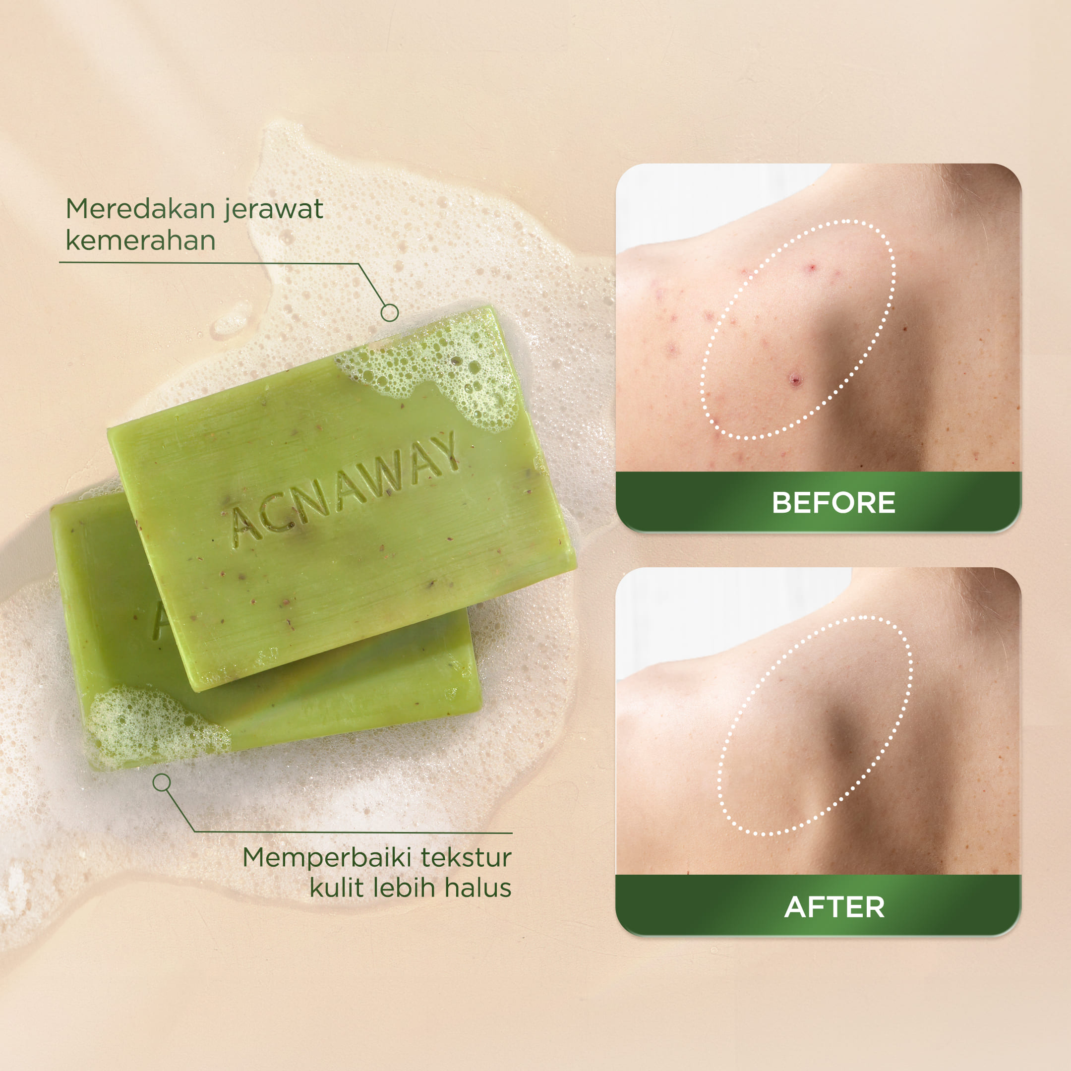 Jual ACNAWAY Mugwort Acne Clear Bar Soap - Sabun Organik Natural Acne ...