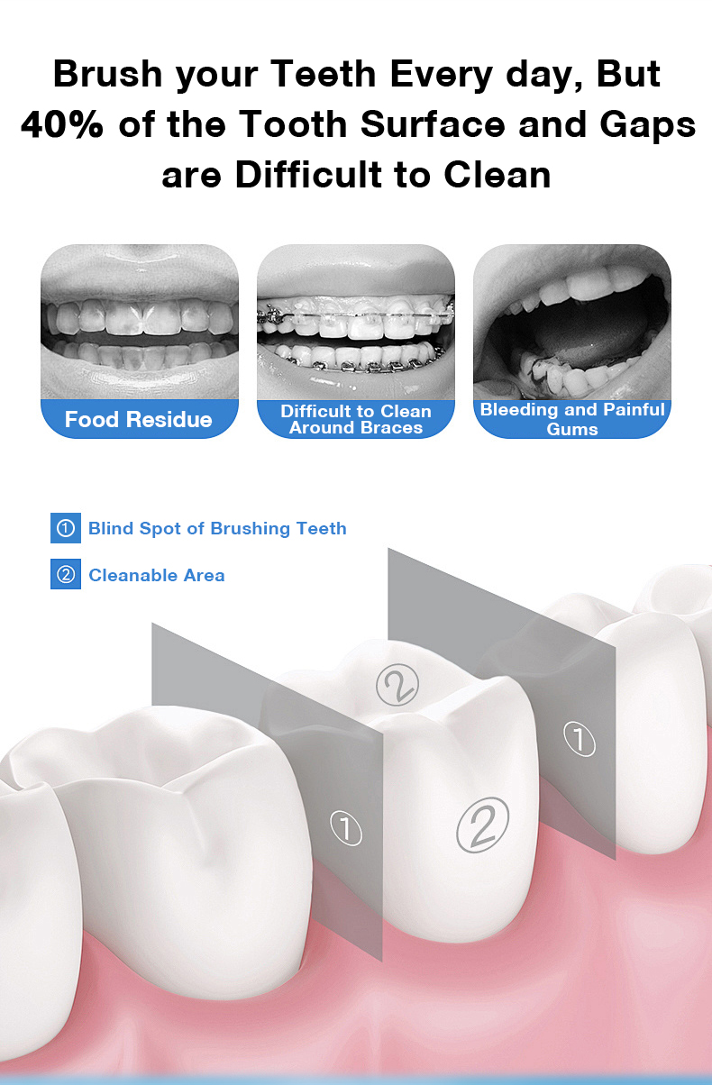 Jual Airuidu CF600 Water Flosser 200ML Foldable Water Floss Gigi Dengan ...