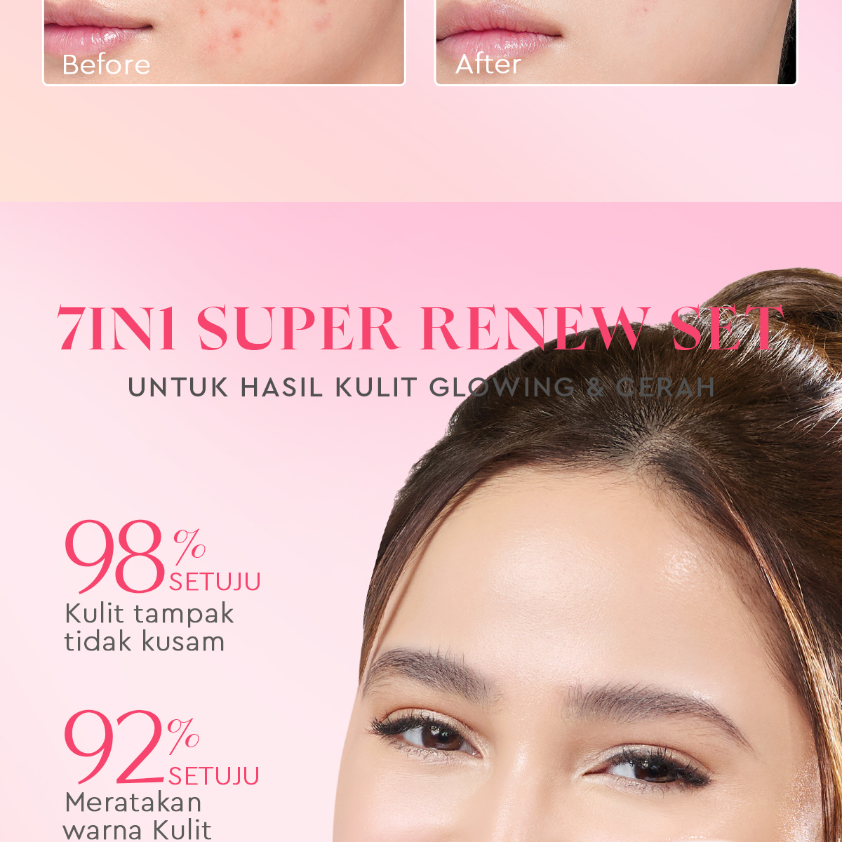 Jual 【Paket Terbaik Putih Wajah】Glad2Glow Renew bundle all in 1 7in1-Brightening toner ...