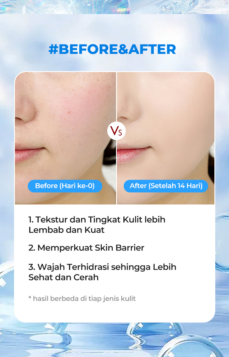 Jual OHSOME - The Originote Hyalucera Moisturizer Gel Pelembab Wajah ...