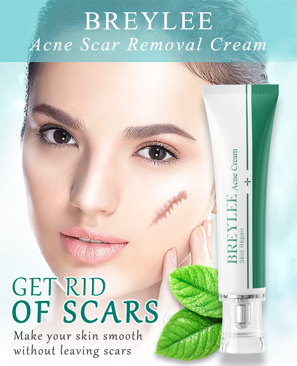 Jual 【BPOM】BREYLEE Acne Scar Removal - BREYLEE Penghilang Noda Bekas Jerawat, Luka & Stretch ...